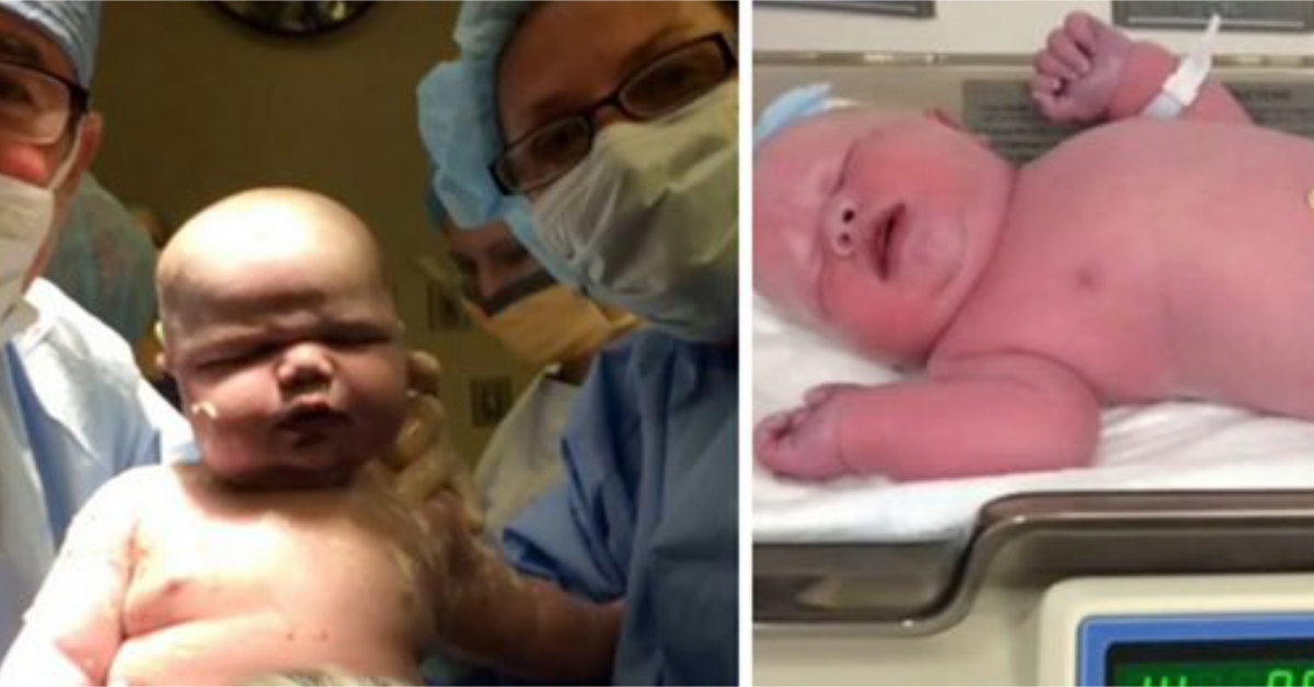 Woman gives birth to a baby the size of a toddler : Secret Life Of Mom