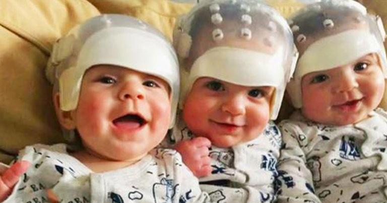 These Are The Rarest Triplets In The Entire World