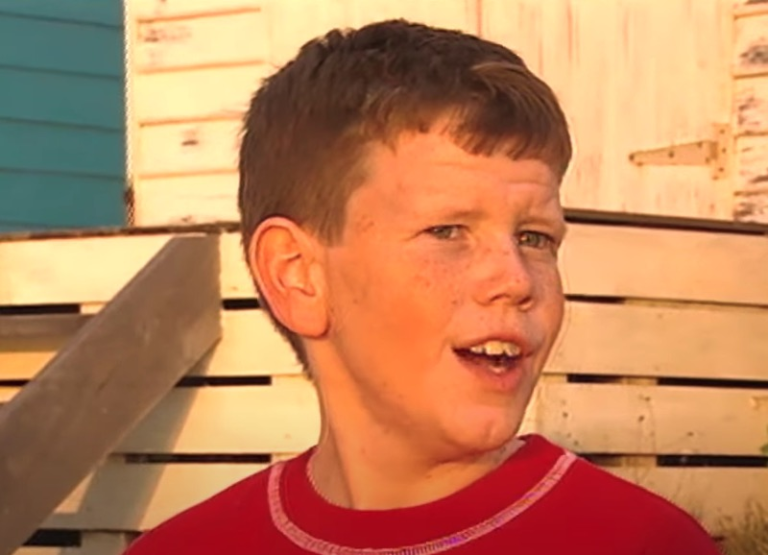 Tomm Tennent: The unique baby born with enough skin for a five-year-old ...