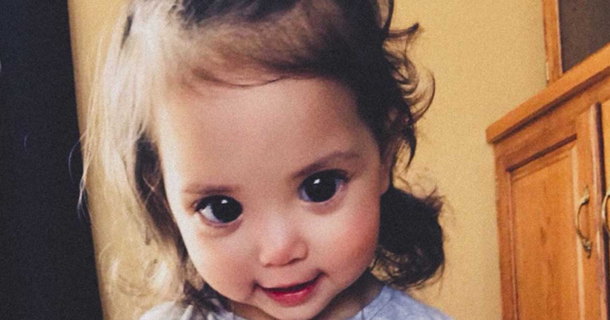 This Little Girl's Big, Beautiful Eyes Are Due To A Rare Medical Condition