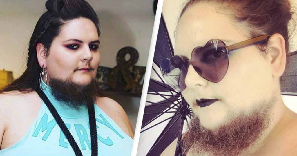 Woman decides to fully embrace her facial hair and grow a beard