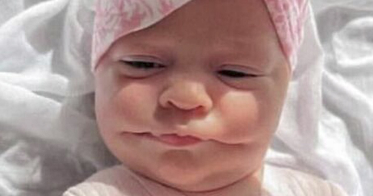 Shocked After Baby is Born With a ‘Permanent Smile’ Condition