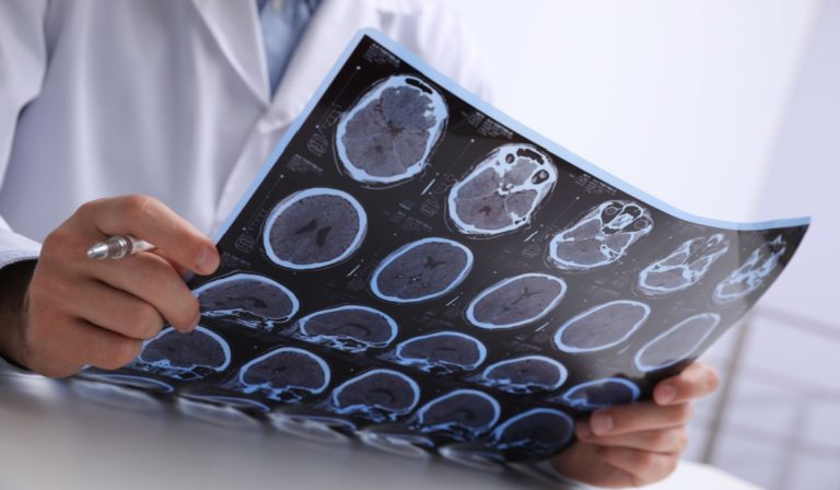 Scott Hamilton’s Inspiring Battle Against a Brain Tumor