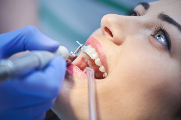 Dentist Explains 7 Key Causes of Yellowing Teeth and How to Prevent It