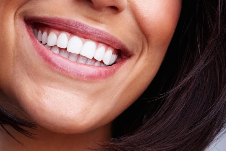 Dentist Explains 7 Key Causes of Yellowing Teeth and How to Prevent It