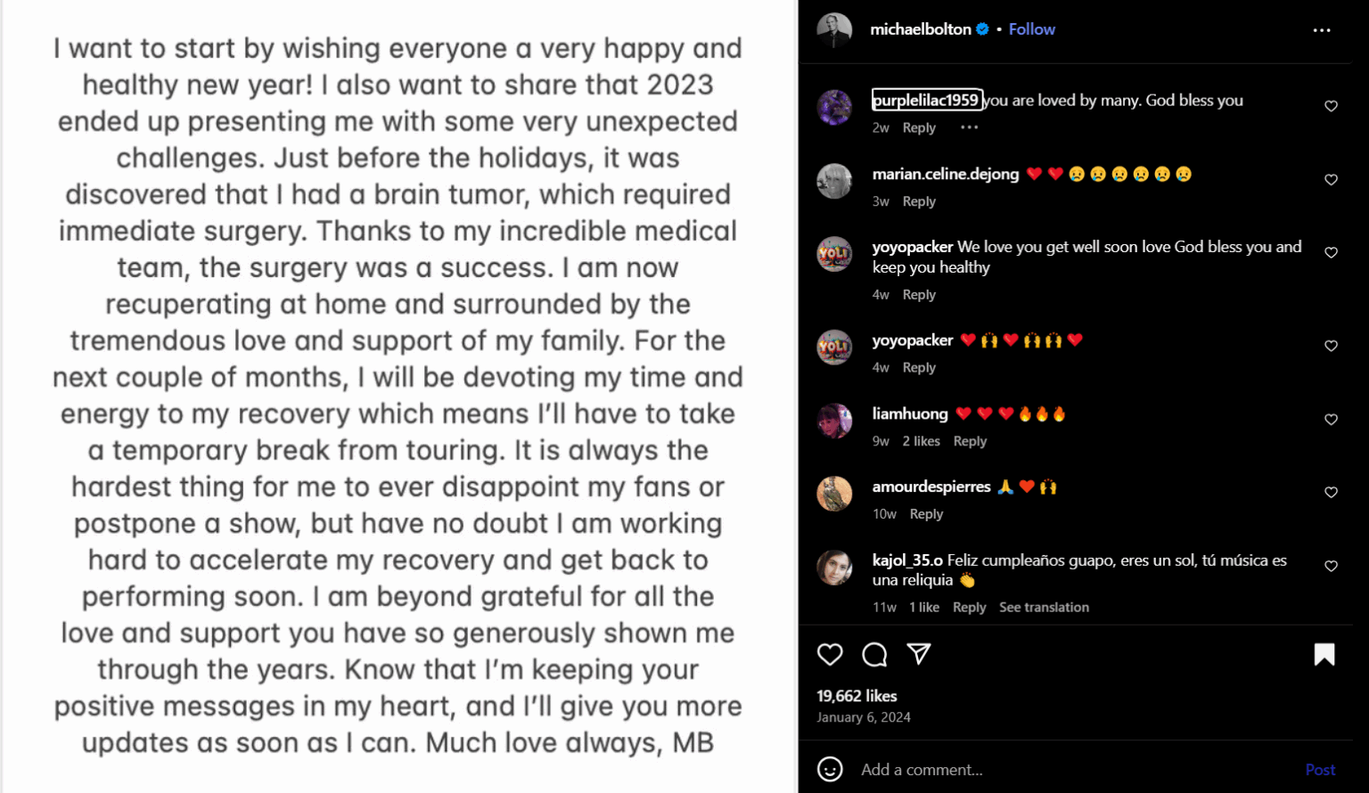 Michael Bolton’s Daughters Share “Strange” Signs Behind His Diagnosis : Secret Life Of Mom