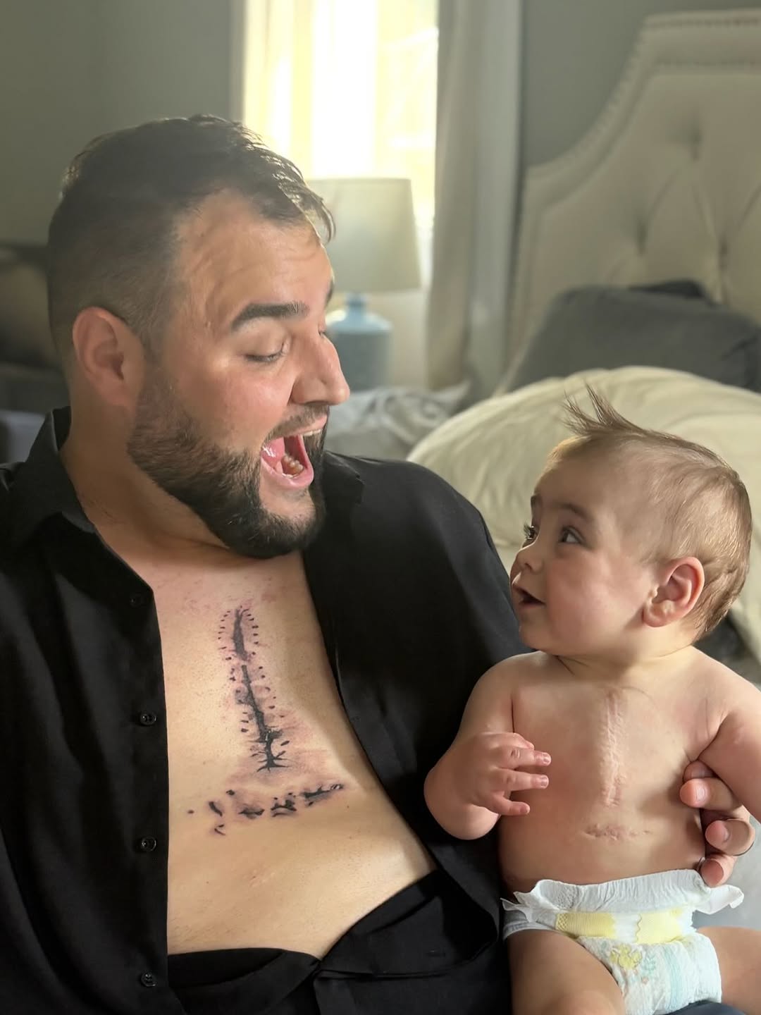Dad Gets Tattoo to Match Son’s Scars After Heart Surgery