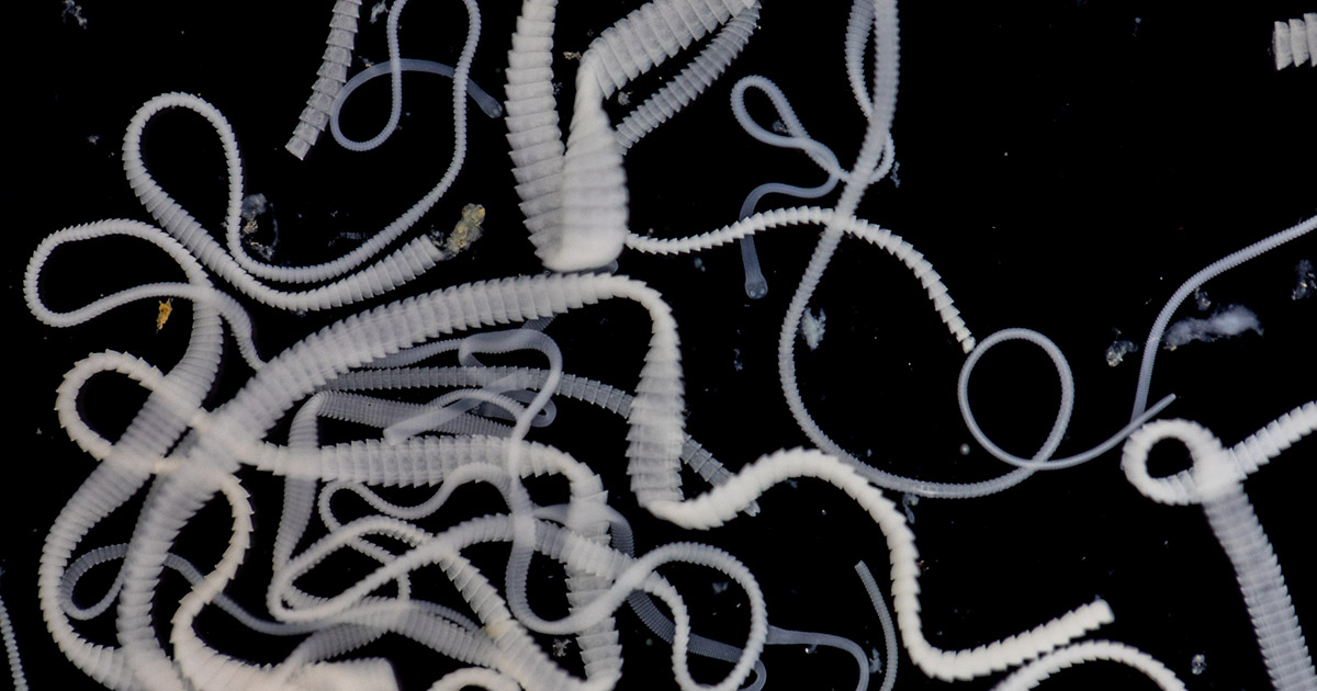 Doctors Thought He Had Brain Cancer. It Was Tapeworm Infection Instead.